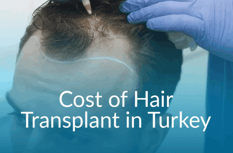 Eyebrow Hair Transplant in Turkey: Guide 2026 | Prof Clinic