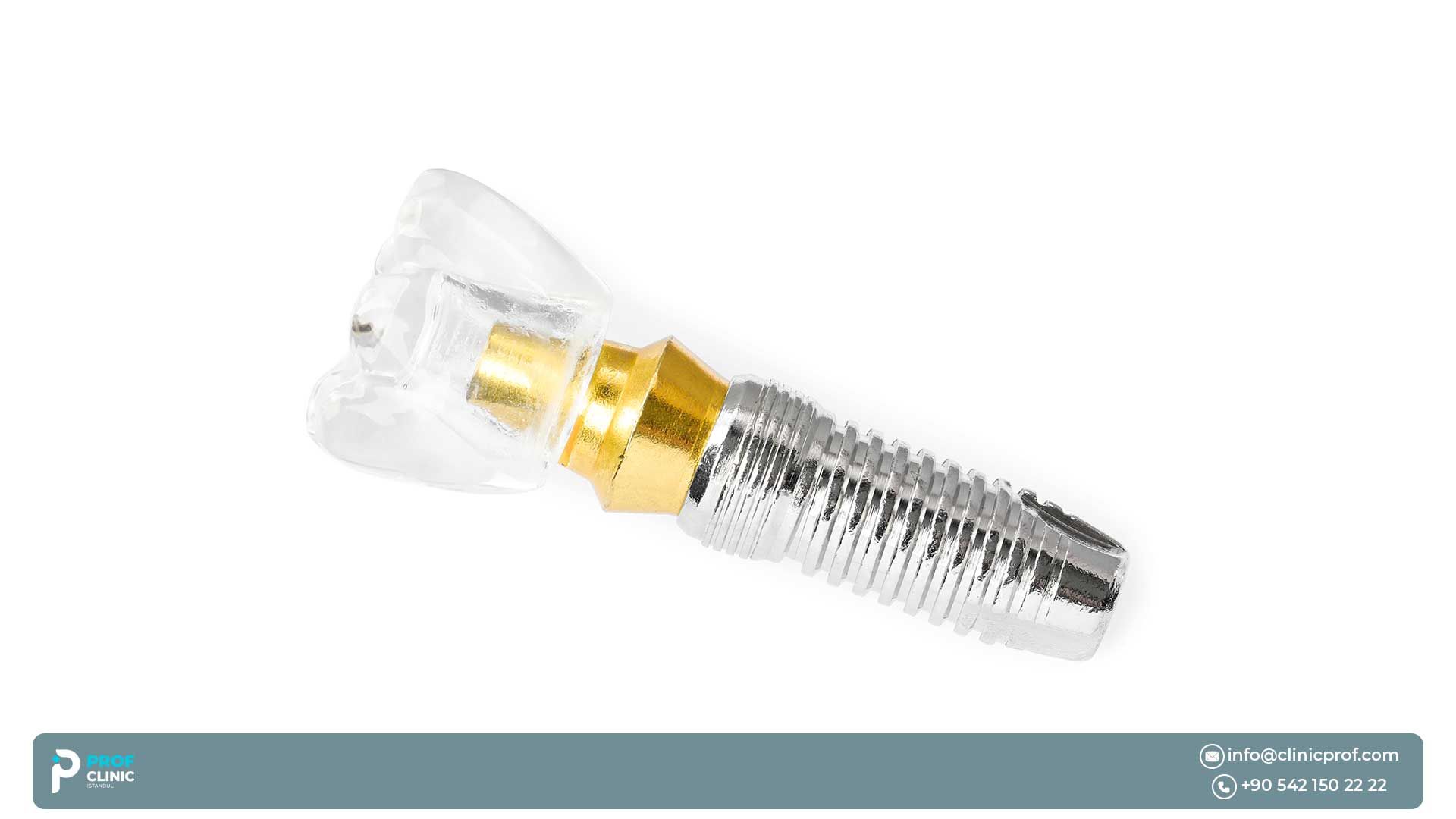Titanium Dental Implants: Cost, Pros & Cons - Prof Clinic